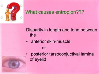 The entropion | PPTX