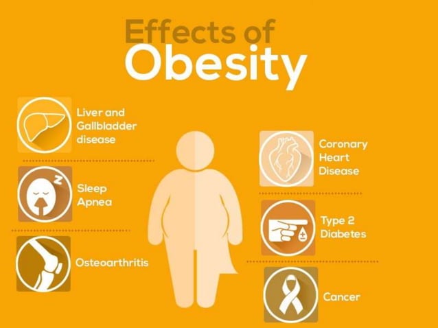 The Epidemic of Obesity | PPT