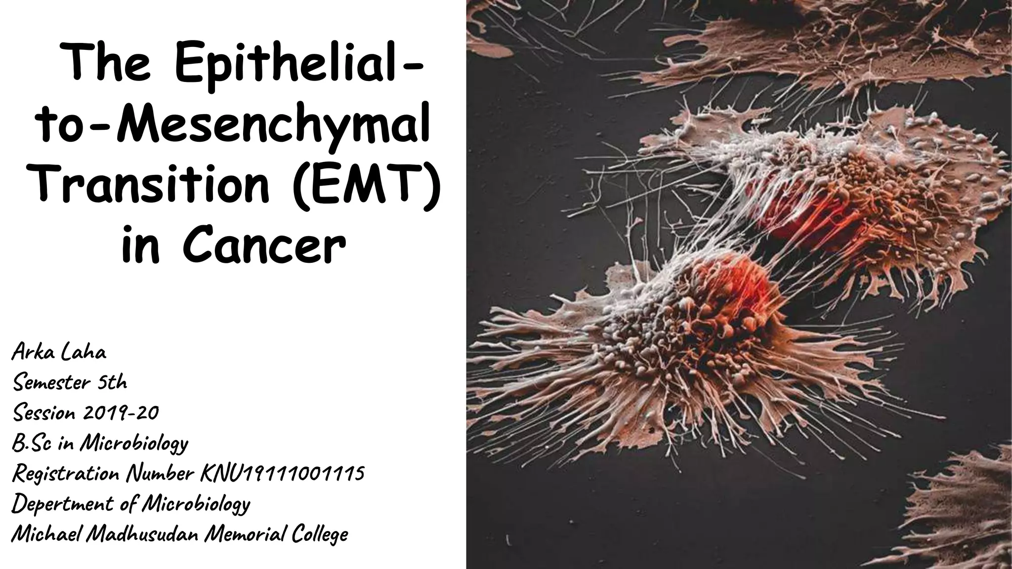 The epithelial to-mesenchymal transition (EMT) in cancer-metastasis ...
