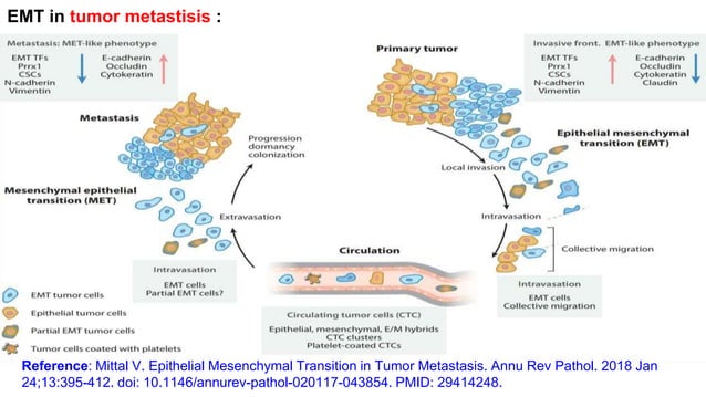 The epithelial to-mesenchymal transition (EMT) in cancer-metastasis ...