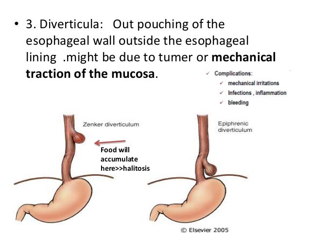 The esophagus