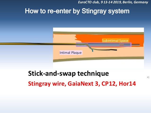 The essentials of guide wires masahisa yamane 9 13 2019