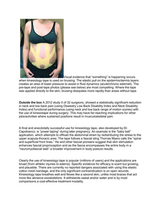 The evolution of kinesiology tape in ontario, canada | PDF