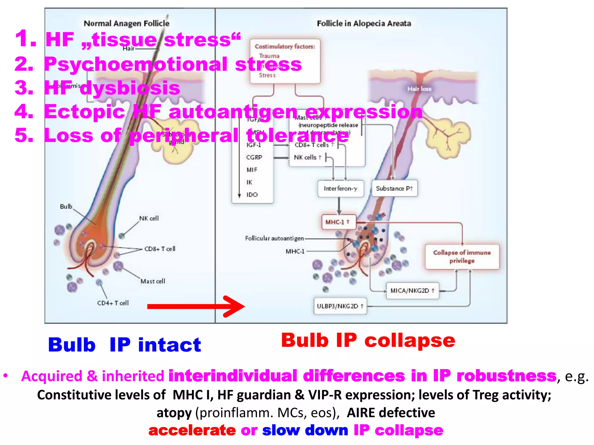 The evolving pathogenesis of alopecia areata and biomarkers of disease ...