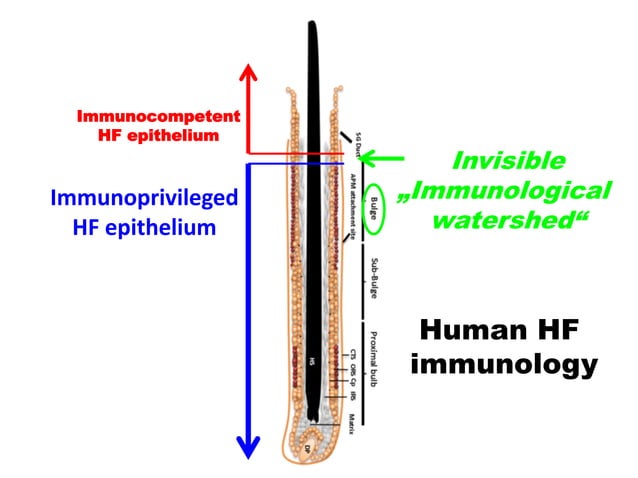The evolving pathogenesis of alopecia areata and biomarkers of disease ...