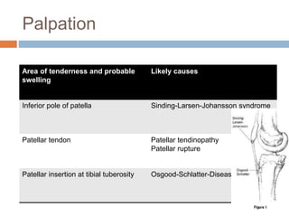 The Examination of the Knee_040716.pptx
