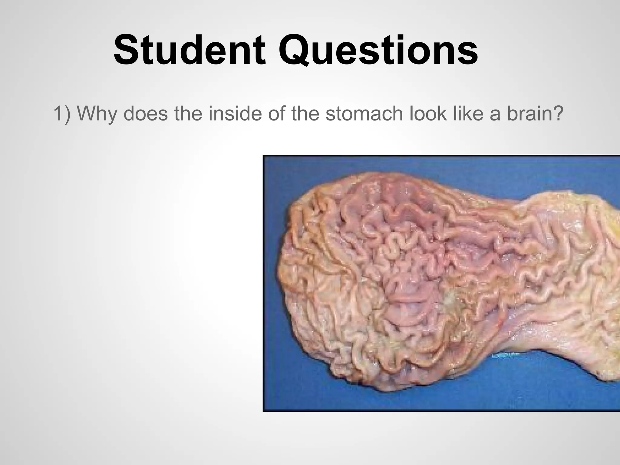 The excretory system1 | PPT