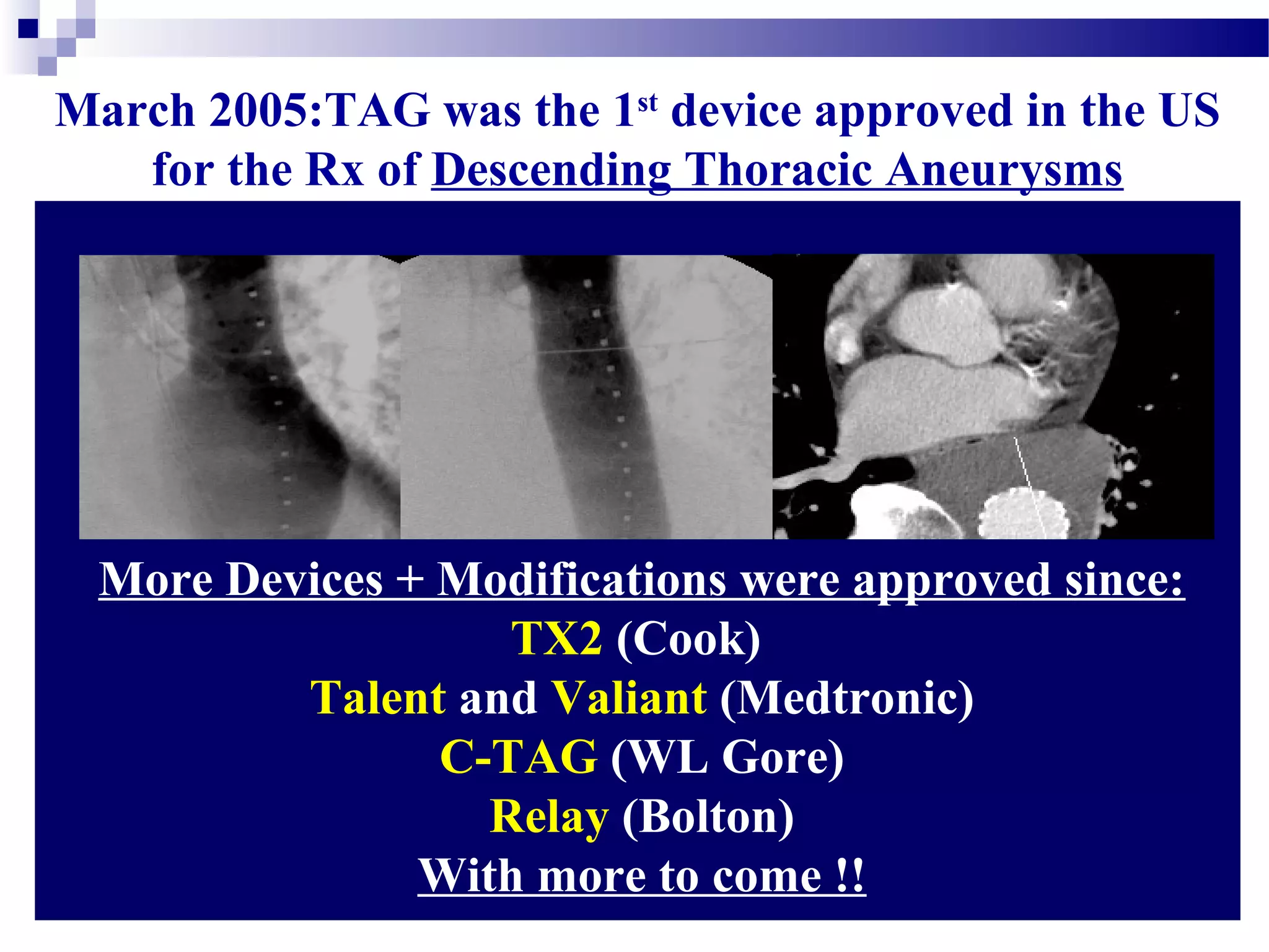 The expanding clinical applications of tevar | PPT