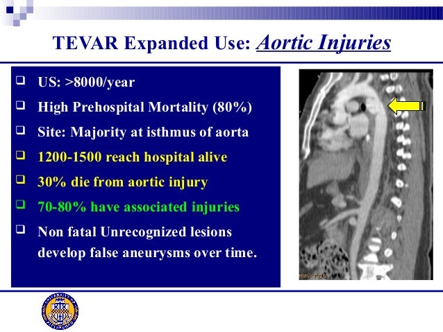 The expanding clinical applications of tevar