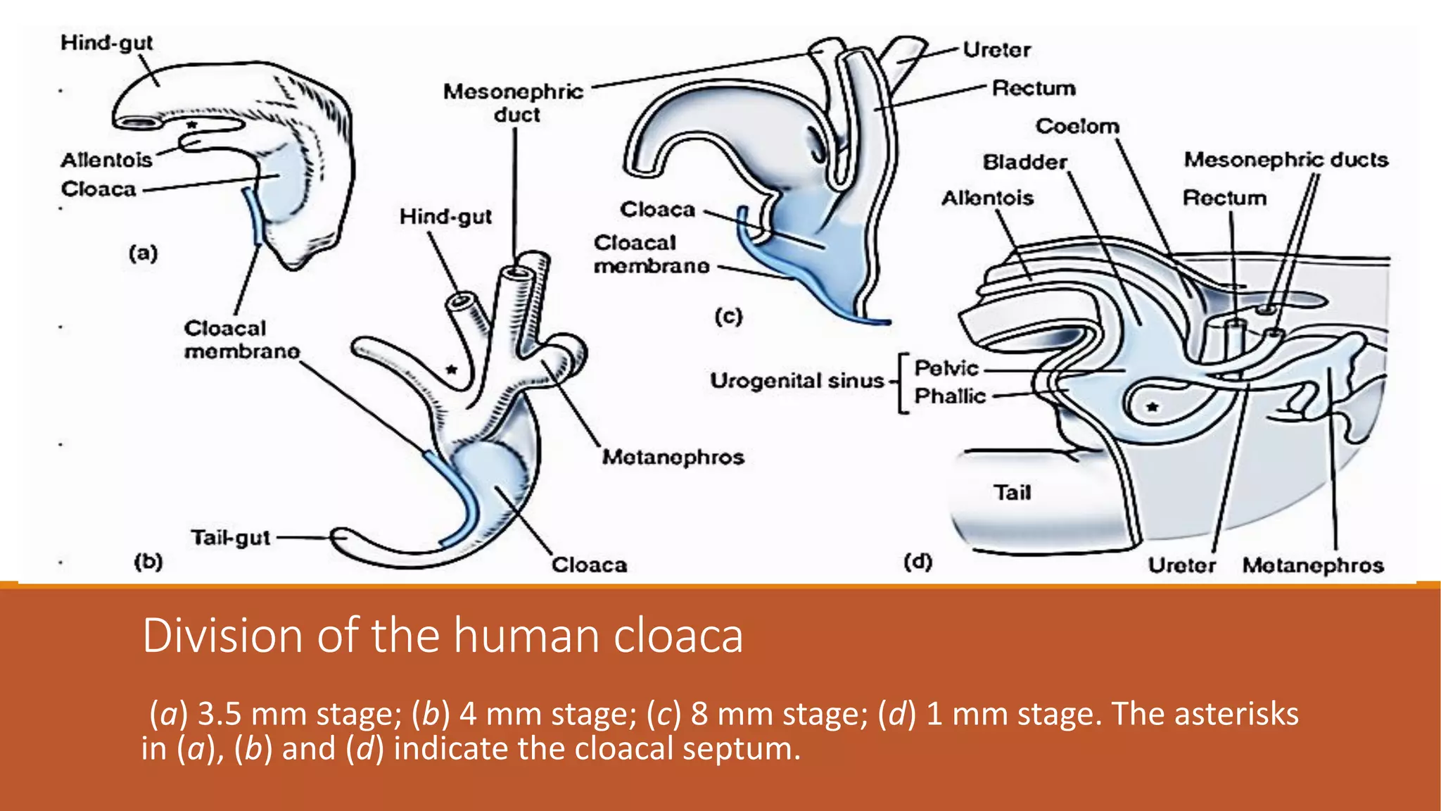 The exstrophy epispadias complex | PDF