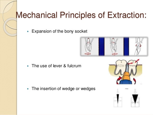 The extraction of teeth