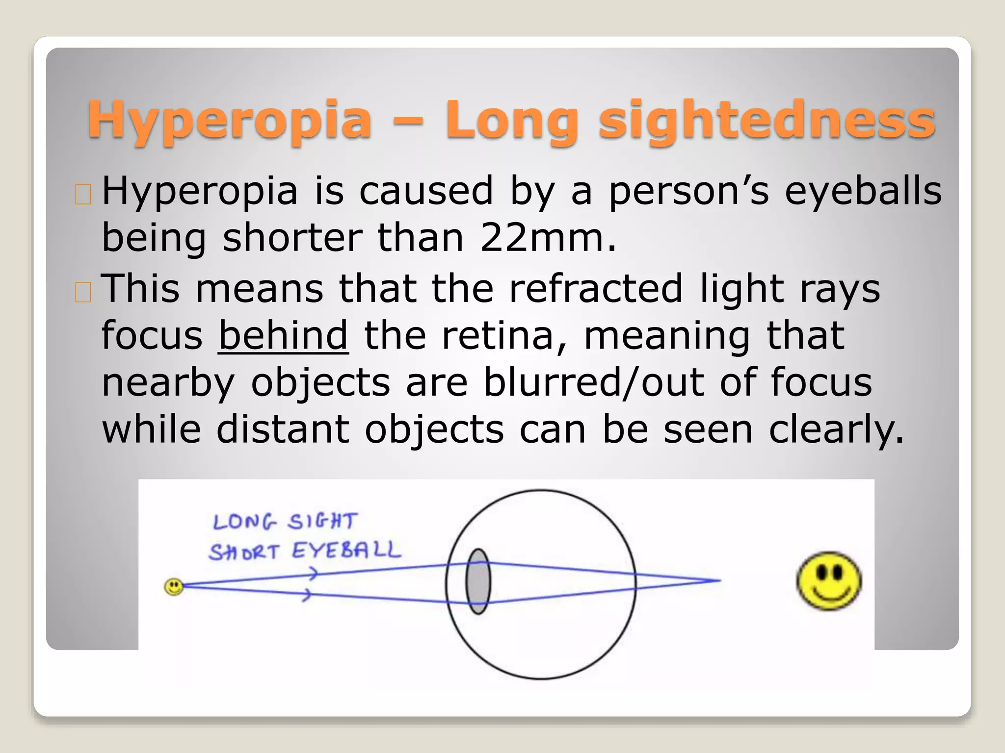 The Eye - Myopia, Hyperopia, Lenses and Laser Eye Surgery | PPT