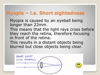 The Eye - Myopia, Hyperopia, Lenses and Laser Eye Surgery | PPTX