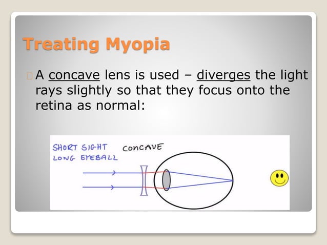 The Eye - Myopia, Hyperopia, Lenses and Laser Eye Surgery | PPT