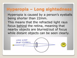 The Eye - Myopia, Hyperopia, Lenses and Laser Eye Surgery | PPTX
