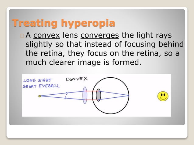 The Eye - Myopia, Hyperopia, Lenses and Laser Eye Surgery | PPT