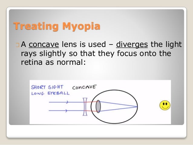 The Eye - Myopia, Hyperopia, Lenses and Laser Eye Surgery