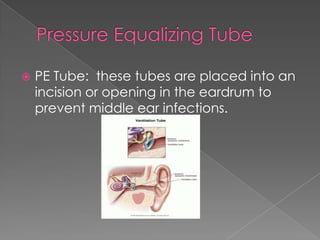 The Eye And Ear | PPTX