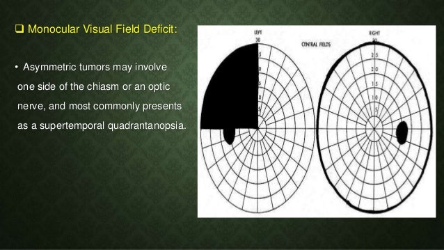 The eye and endocrine system