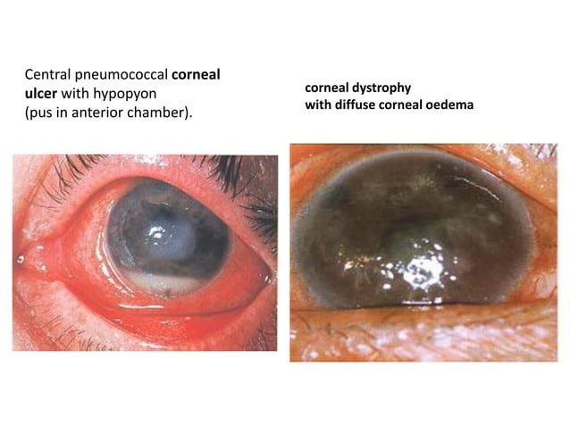 The eyeball anatomy | PDF