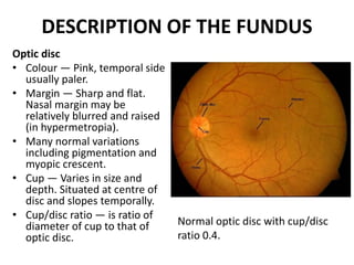 The eyeball anatomy | PDF