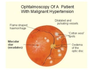 The eyeball anatomy | PDF