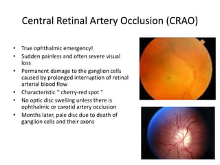 The eyeball anatomy | PDF