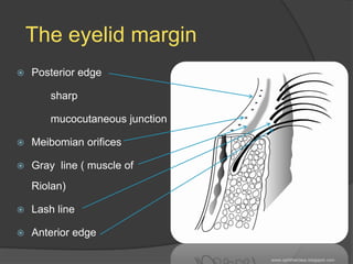 Lids and Adnexa Class1: The eyelid margin | PPTX