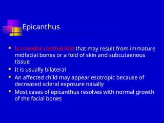 The_eyelids_and_the_lacrimal_apparatus (2).ppt