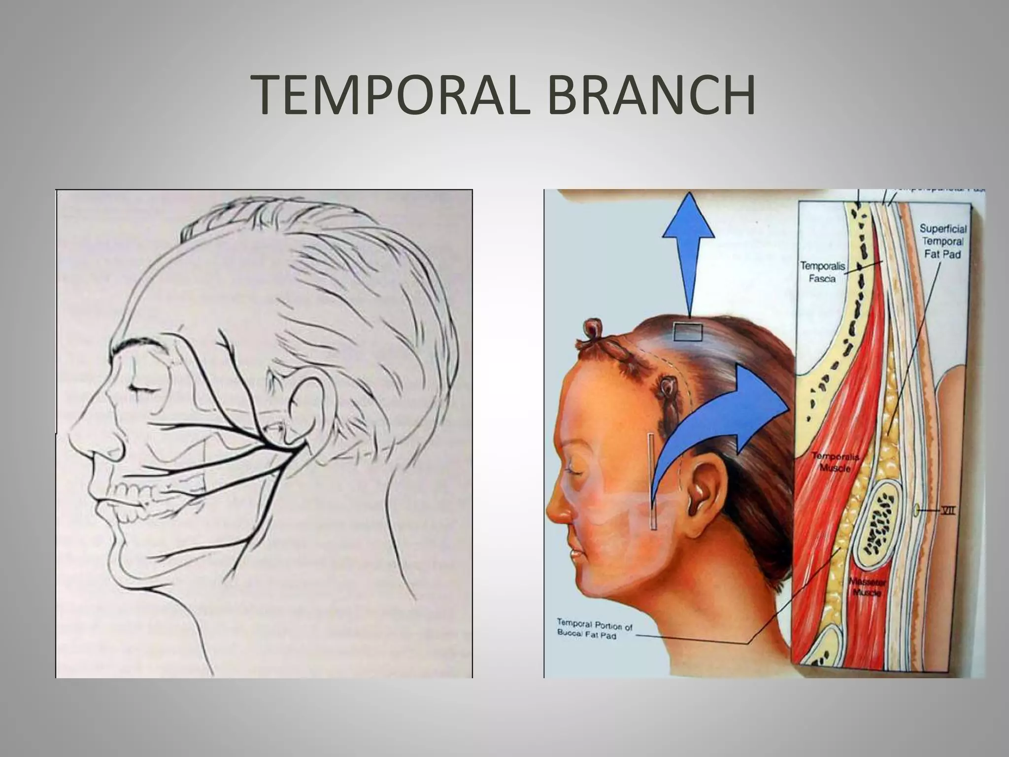 The facial nerve | PPTX