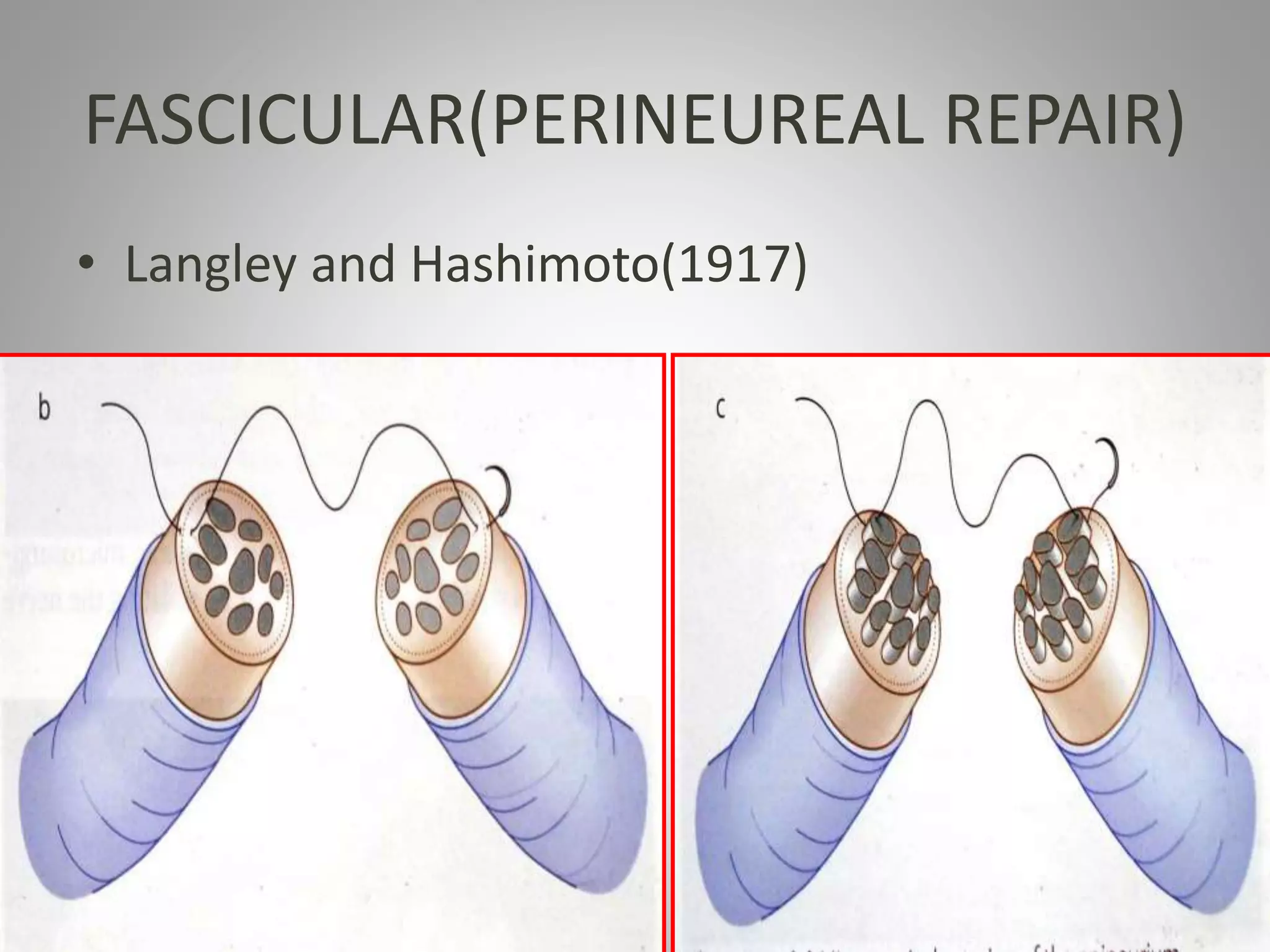 The facial nerve | PPTX
