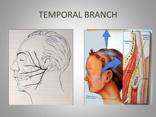 The facial nerve | PPTX