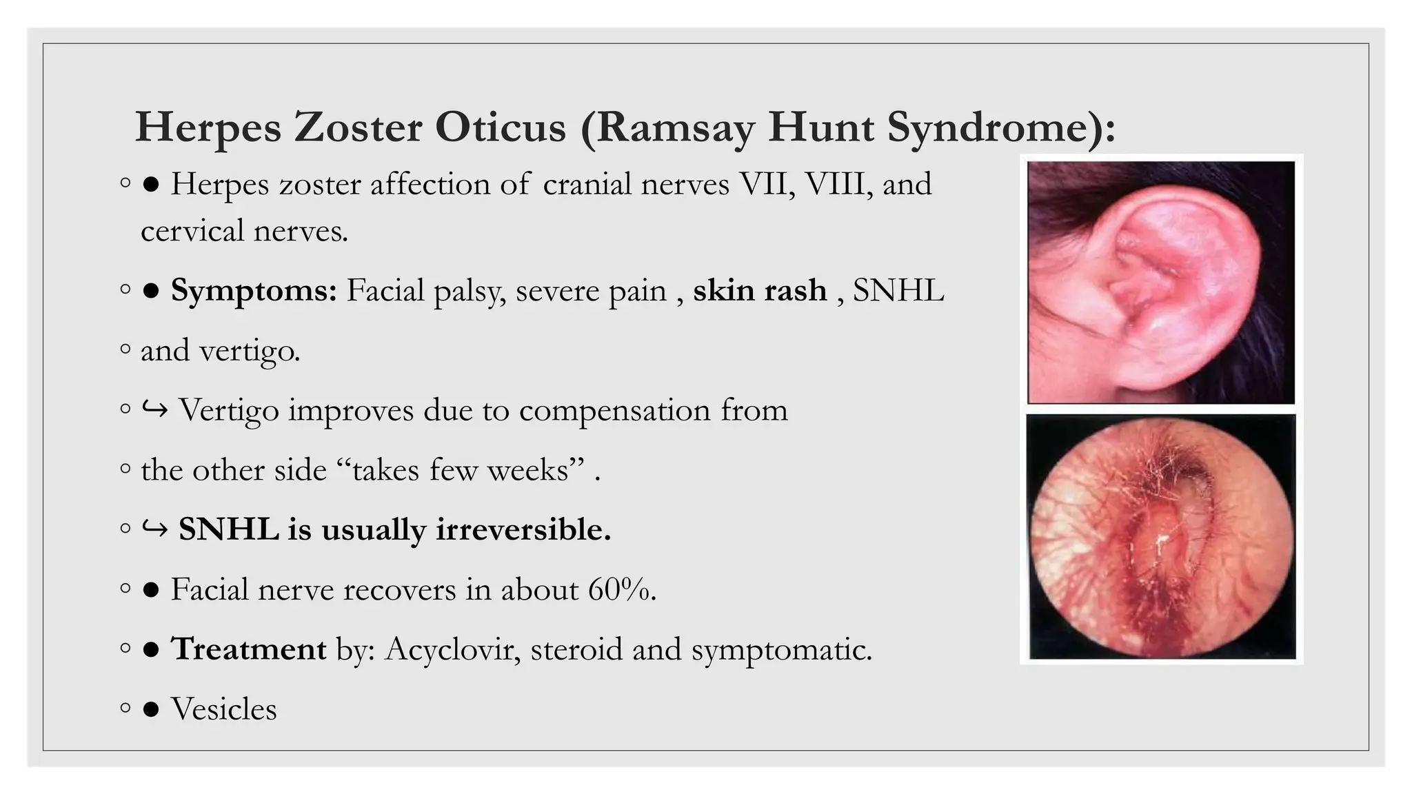The facial nerve- anatomy and clinical examination | PPTX