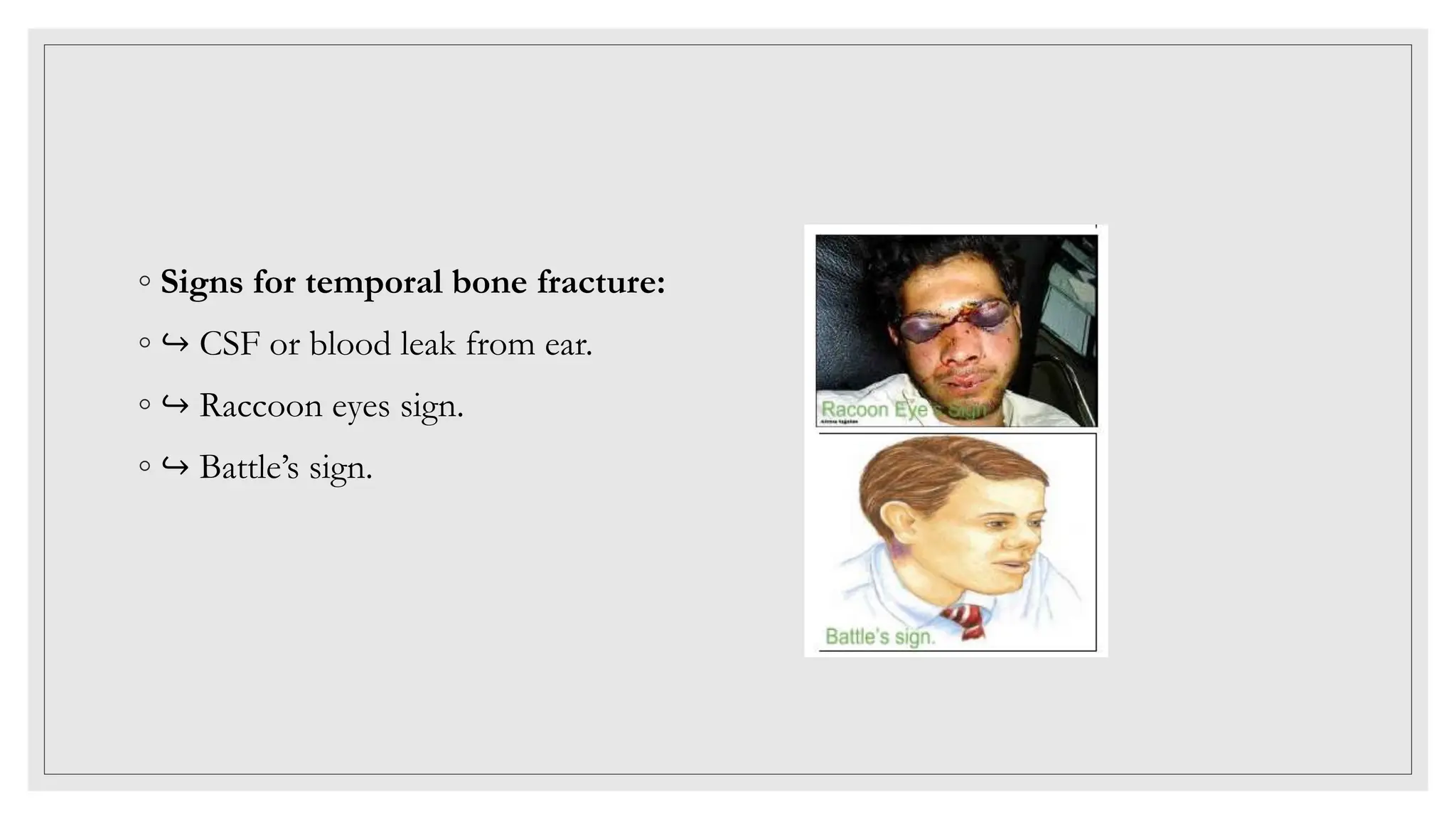 The facial nerve- anatomy and clinical examination | PPTX