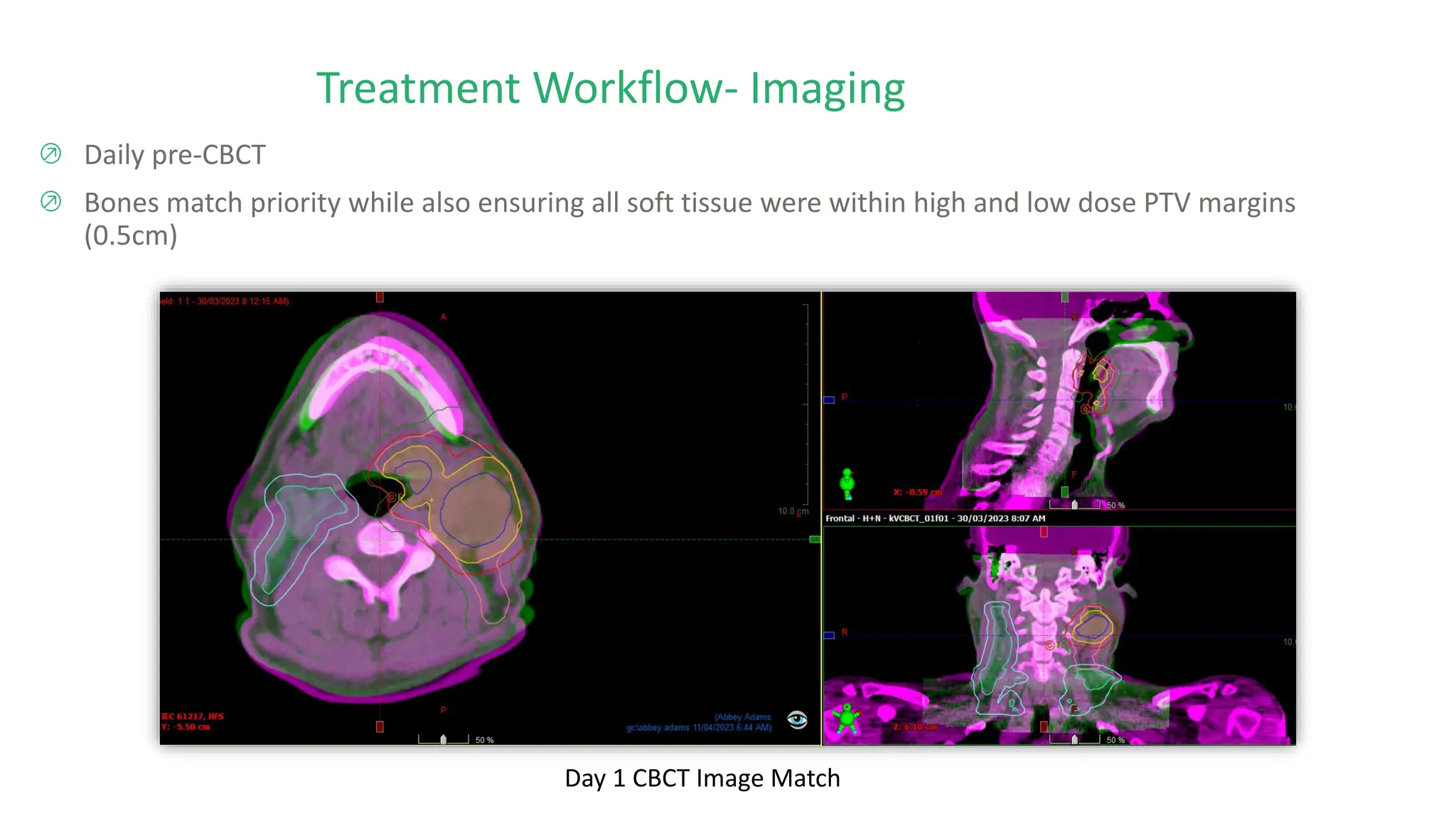 The feasibility of maskless radiation therapy for head and neck cancer ...
