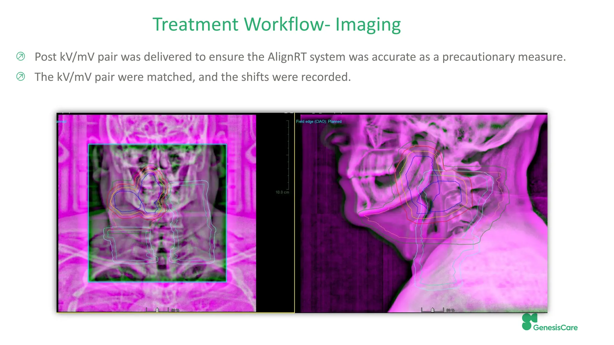 The feasibility of maskless radiation therapy for head and neck cancer ...