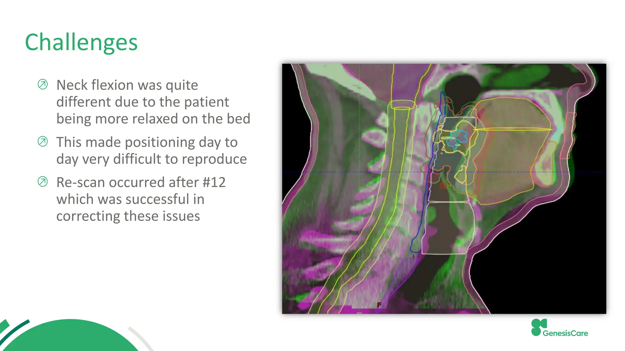 The feasibility of maskless radiation therapy for head and neck cancer ...