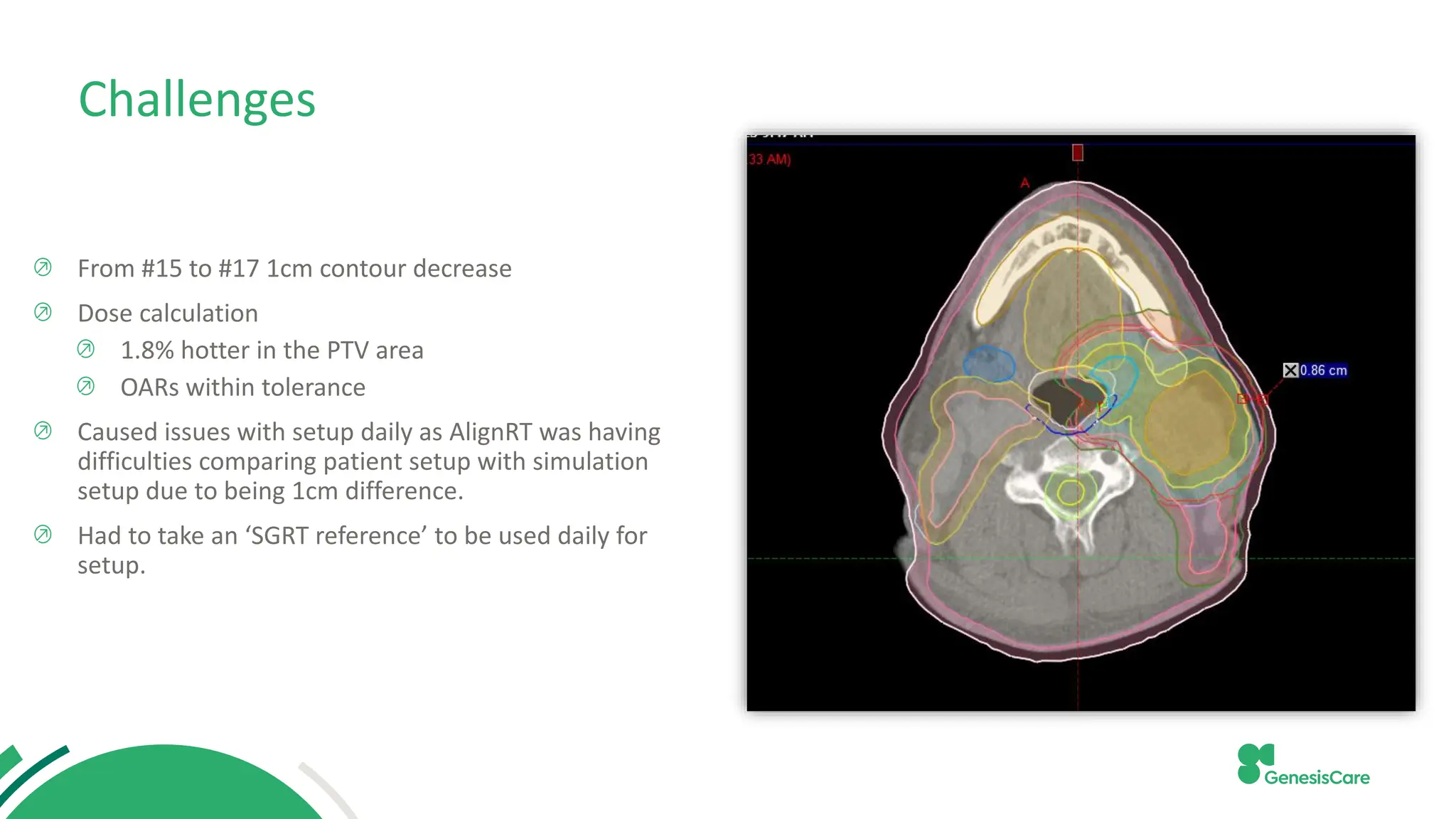 The feasibility of maskless radiation therapy for head and neck cancer ...