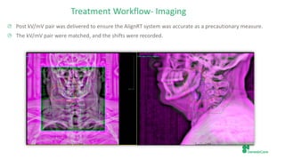 The feasibility of maskless radiation therapy for head and neck cancer ...