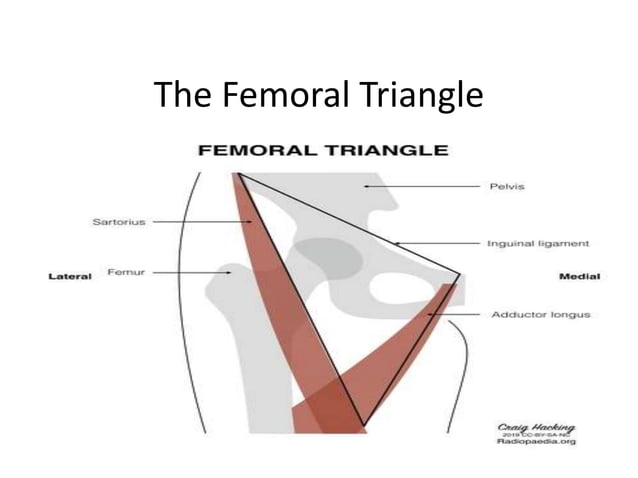 The Femoral Triangle.pptx | Death, Injury, or Military Conflict ...