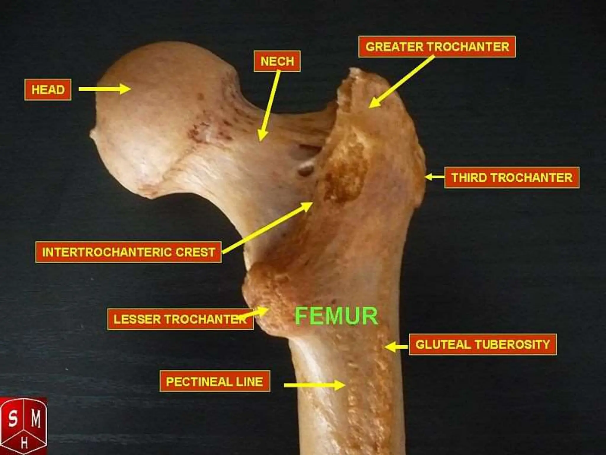 The anatomy of Femur features and attachments.pptx