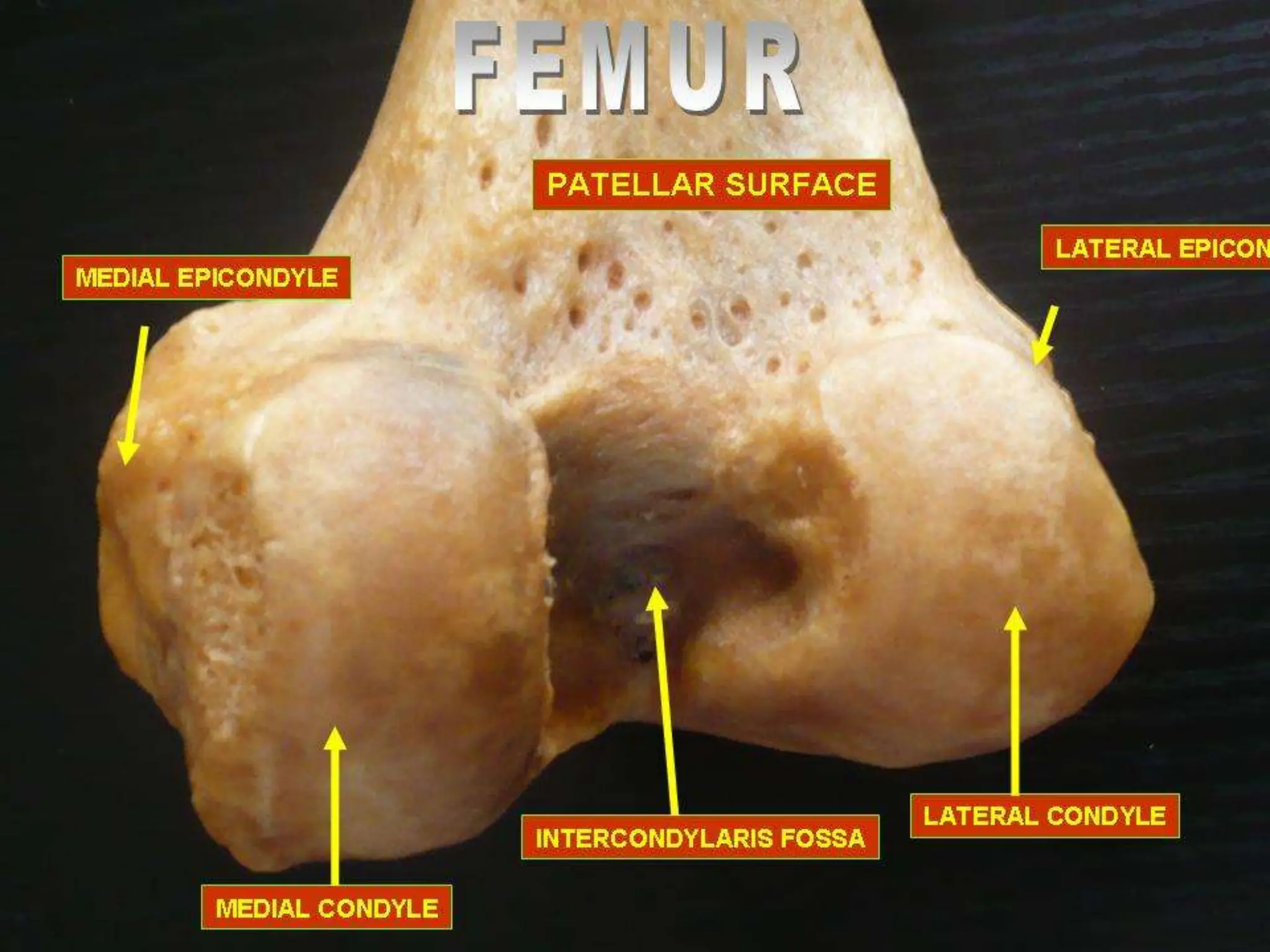 The anatomy of Femur features and attachments.pptx