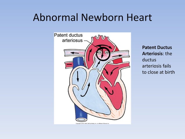 The fetal and newborn heart pdf | PDF