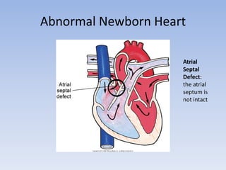 The fetal and newborn heart pdf | PPT