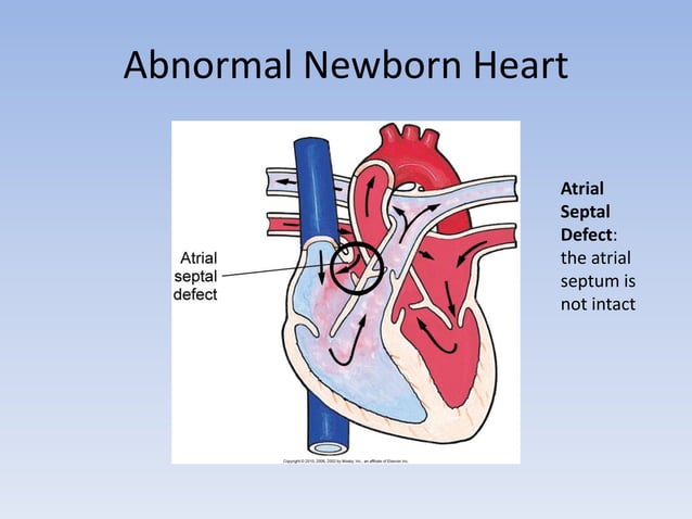 The fetal and newborn heart pdf | PDF