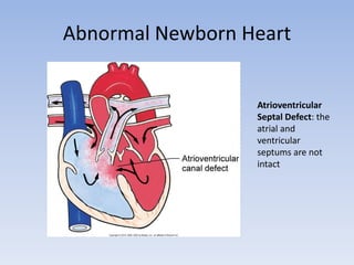 The fetal and newborn heart pdf | PDF