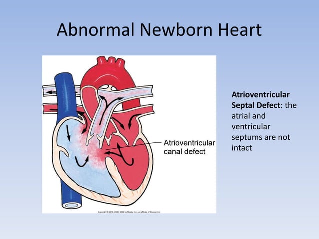 The fetal and newborn heart pdf | PPT