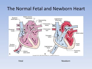 The fetal and newborn heart pdf | PPT