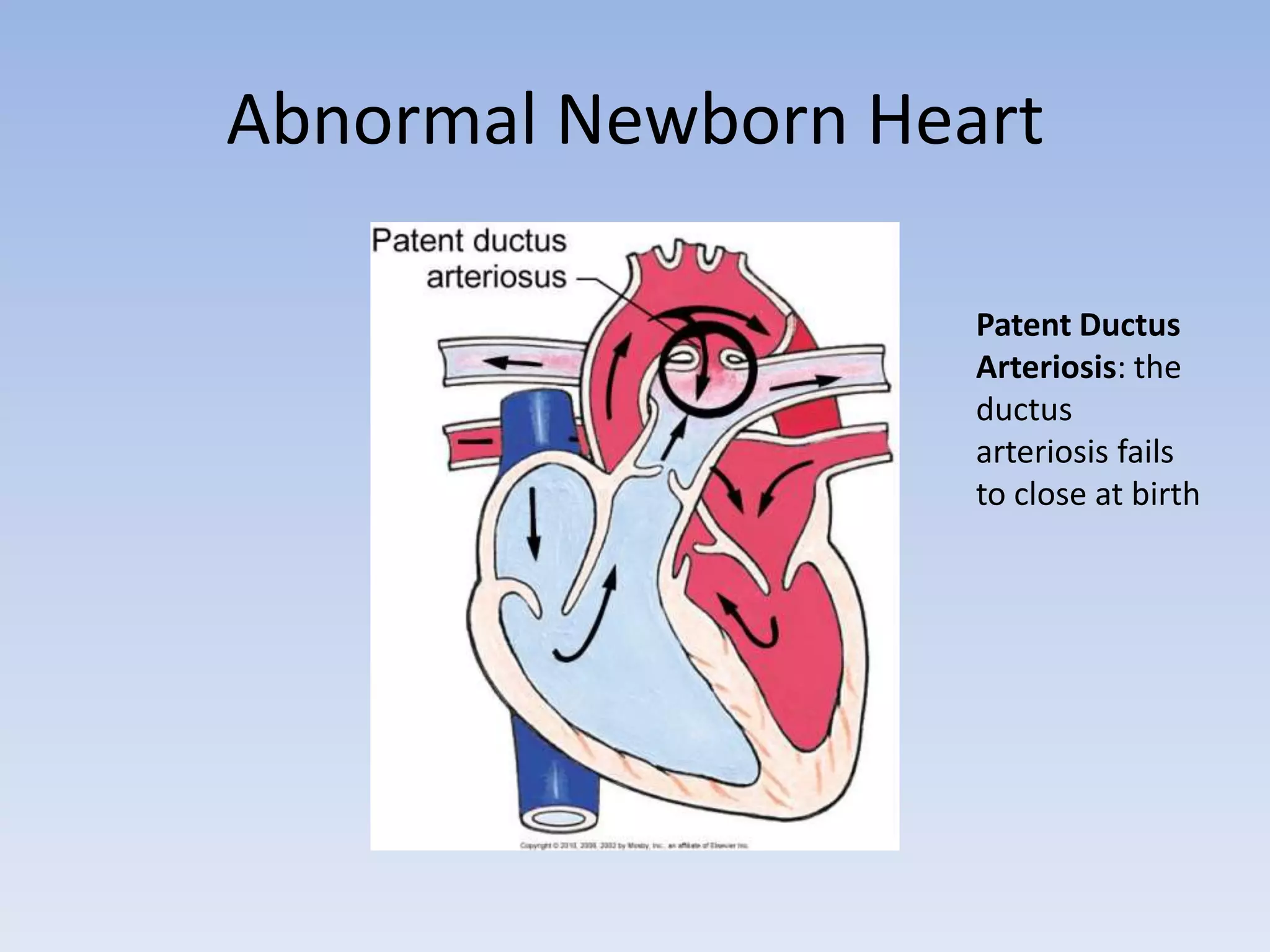 The fetal and newborn heart ppp | PPTX