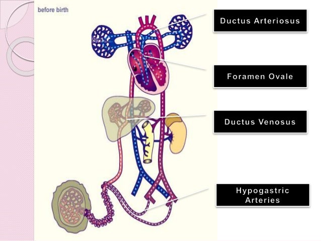 Persistent Fetal Circulation